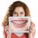 FastBraces (Orthodontics) - Hill Park Dental